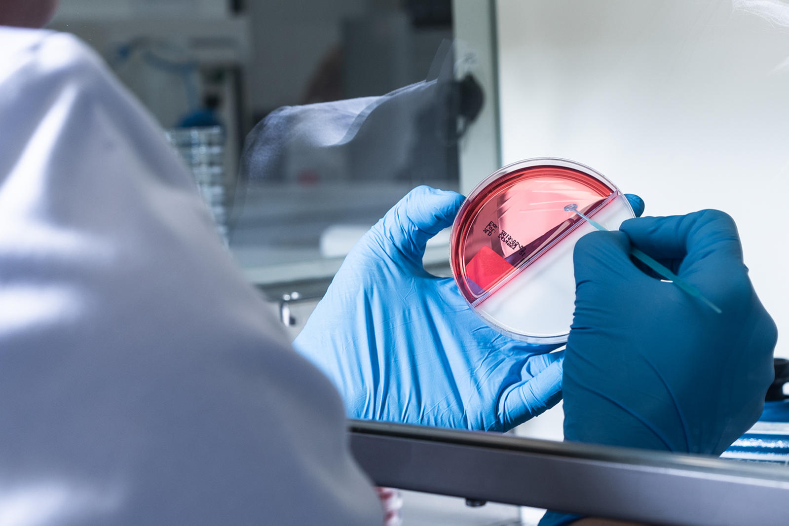 Antimicrobial Testing - Nova Biologicals